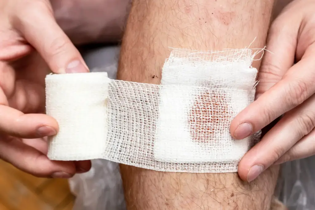 Feridas de diabetes: Conheça os 3 tipos principais